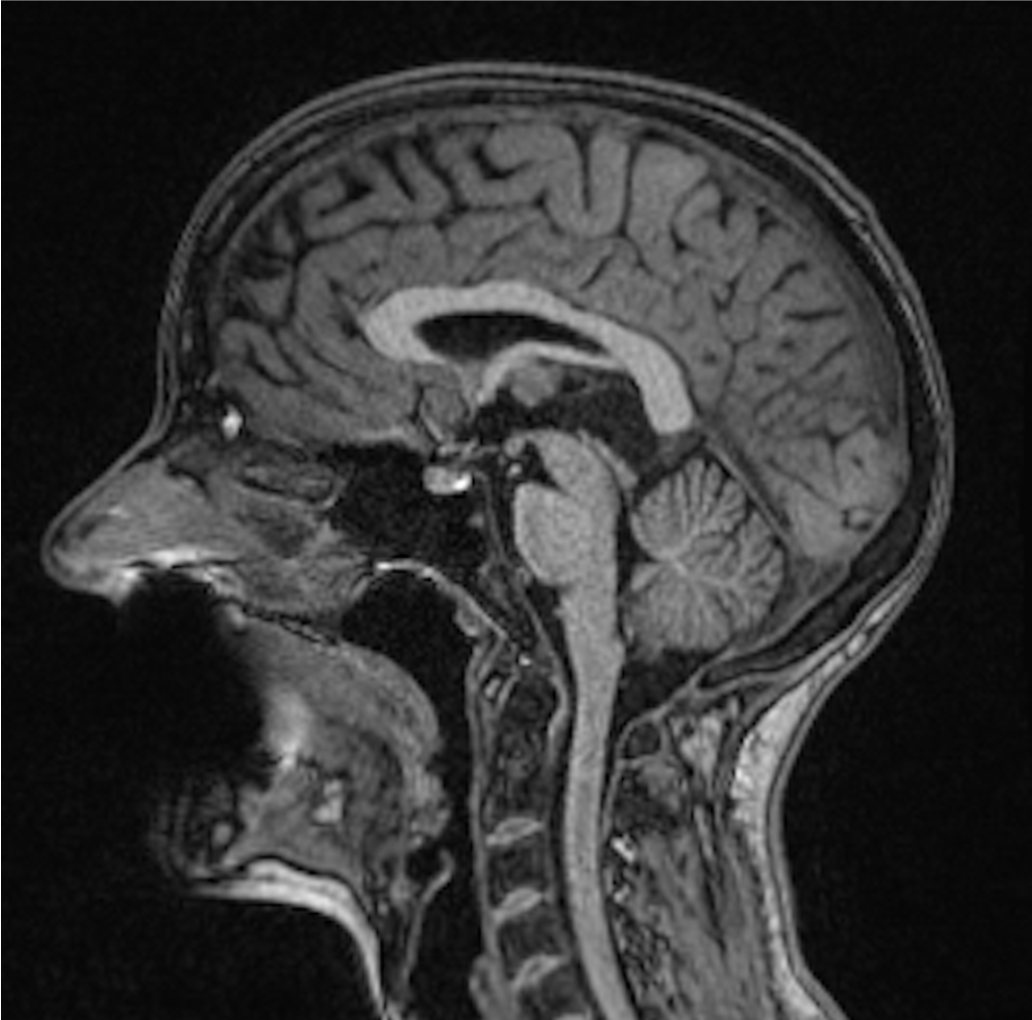 Full-Body MRI: Benefits, Risks, and My Experience